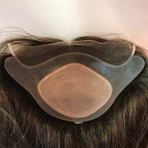 Top of Head Systems | Toppers | Top of Head Wigs for Cancer